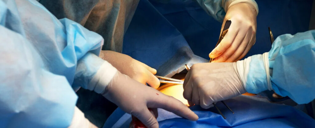 Tubectomy – Mithra Hospital
